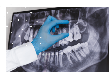 Family Dentistry Los Angeles | Dental Exam / X-ray